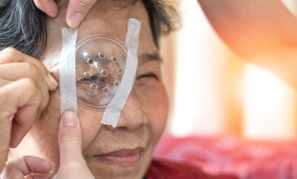 What to Expect with Cataract Surgery: Before, During and After - Swagel ...
