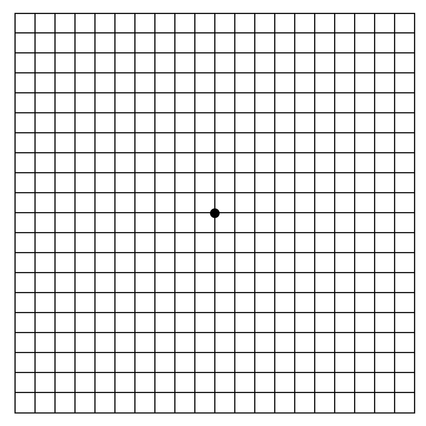 Amsler Grid Vision Test for AMD - LASIK Arizona | Cataract Surgery